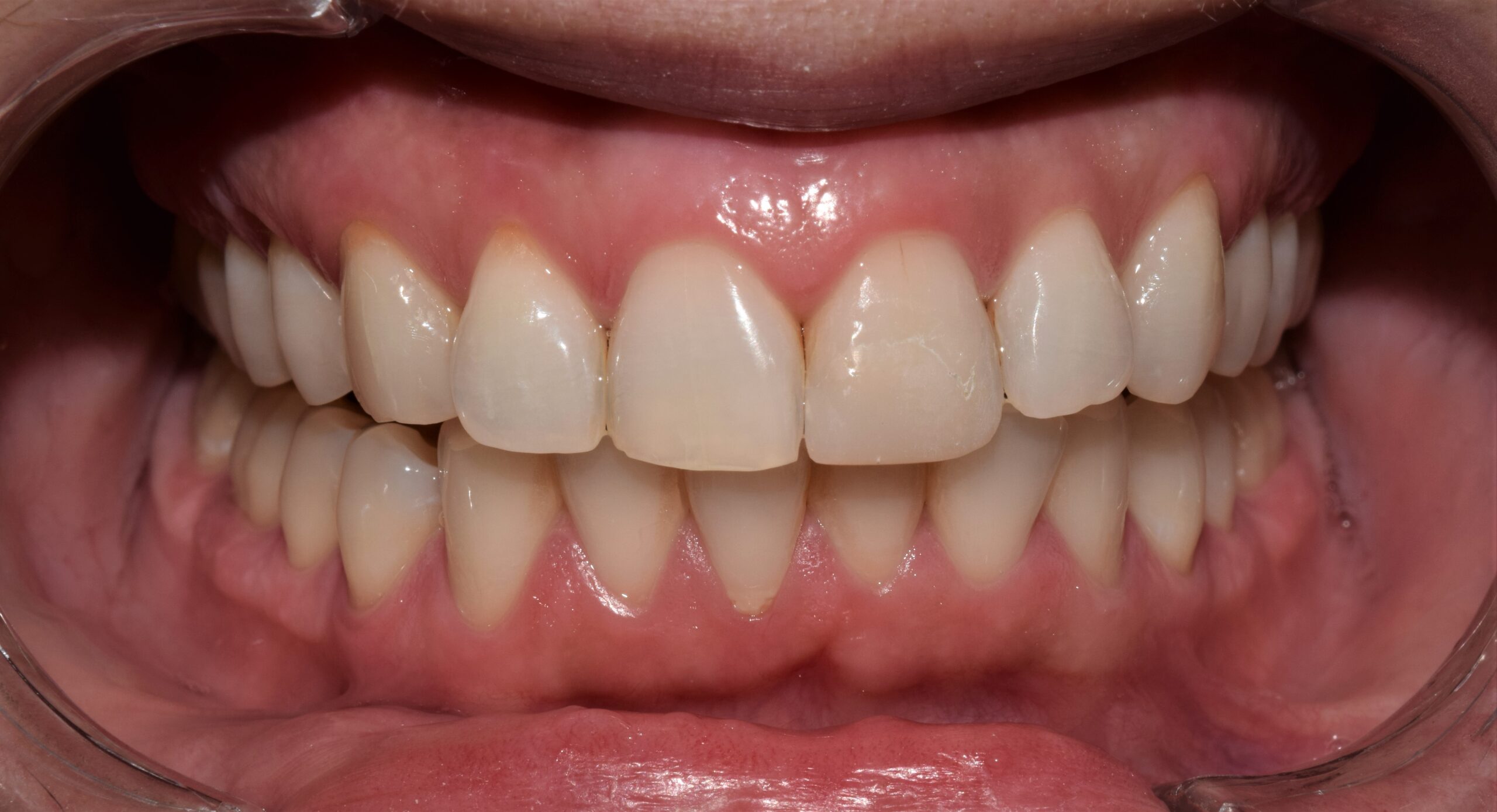 Galerija osmijeha - ORDINACIJA DENTALNE MEDICINE DR.BUCIĆ